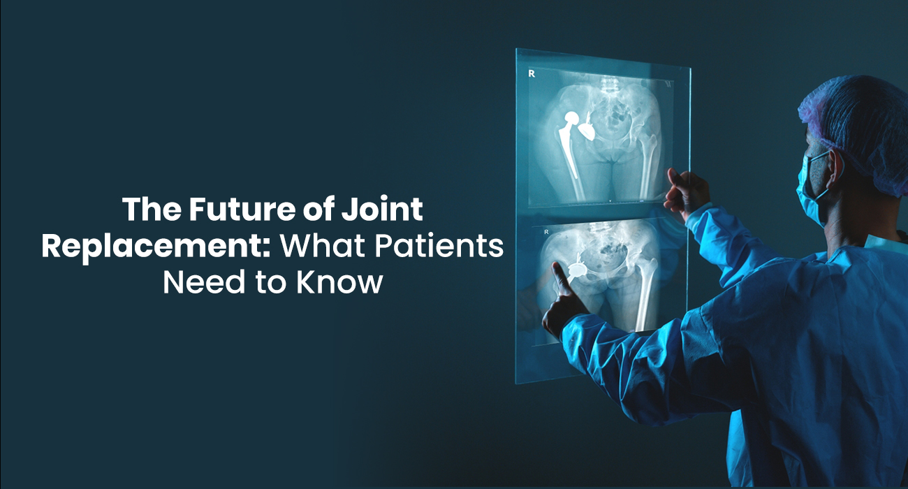 The Future of Joint Replacement: What Patients Need to Know : Eternal ...
