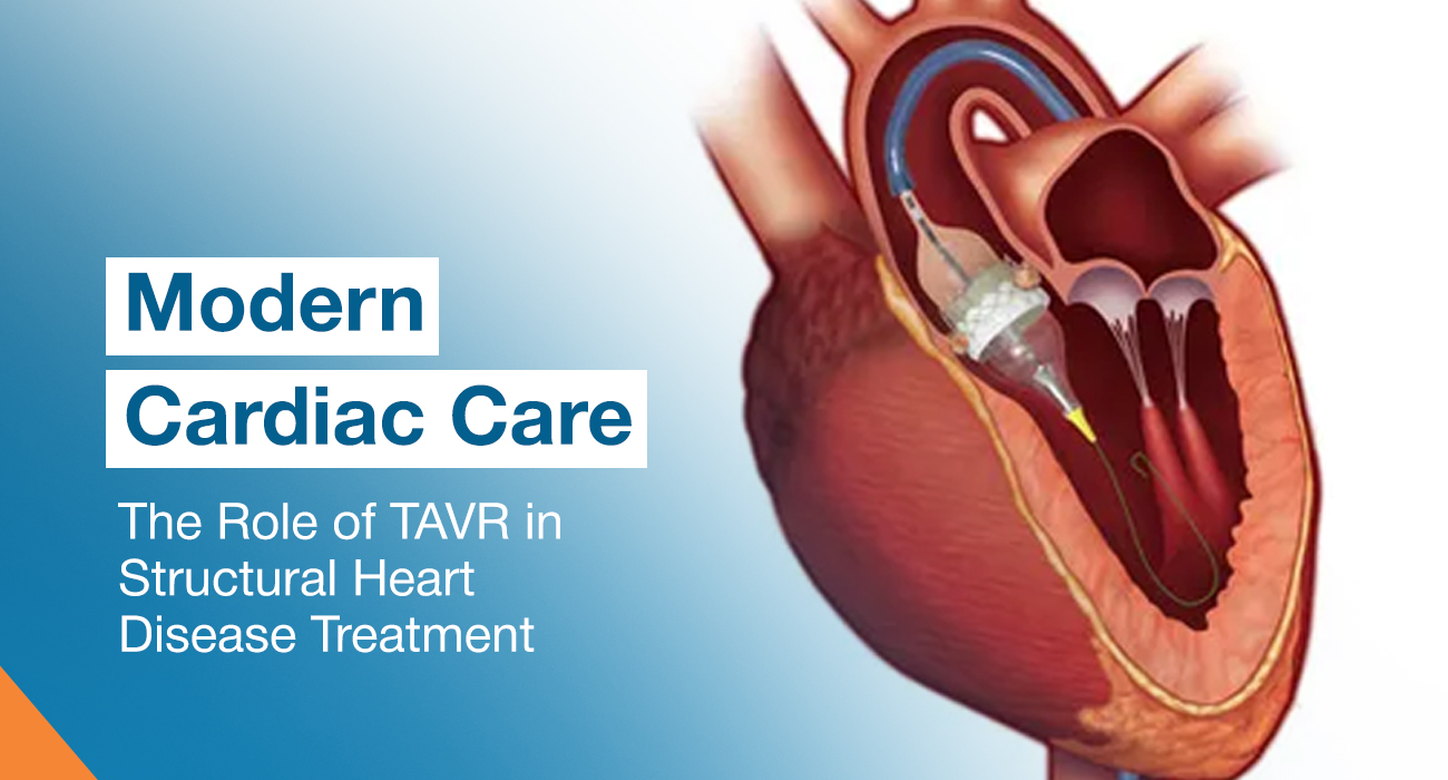Modern Cardiac Care: TAVR in Structural Heart Disease : Eternal Hospital